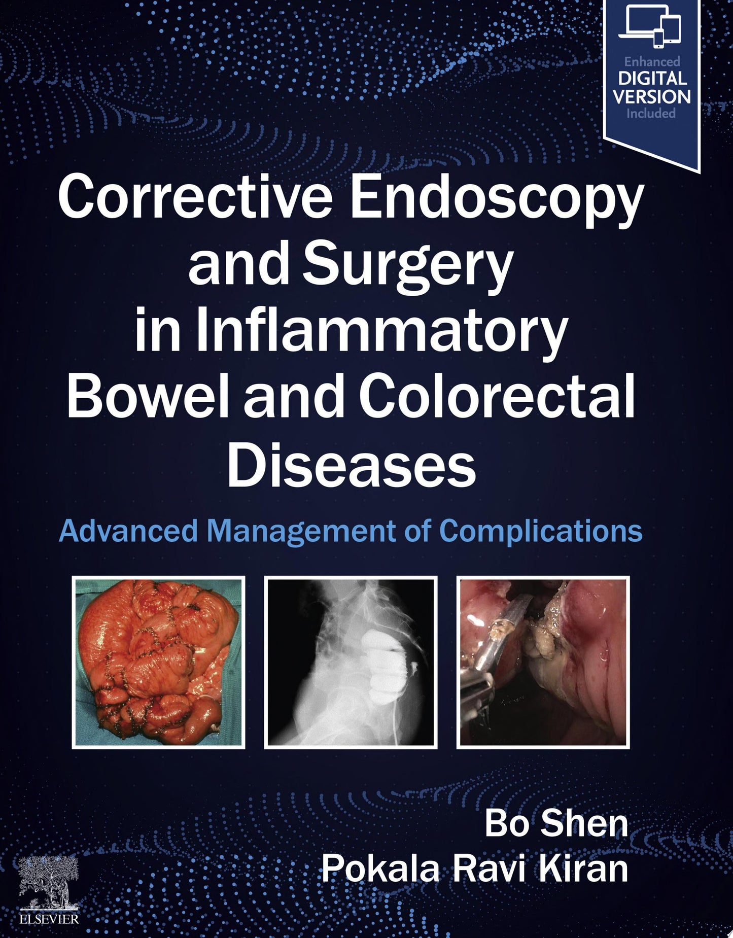 Corrective Endoscopy and Surgery in Inflammatory Bowel and Colorectal ...